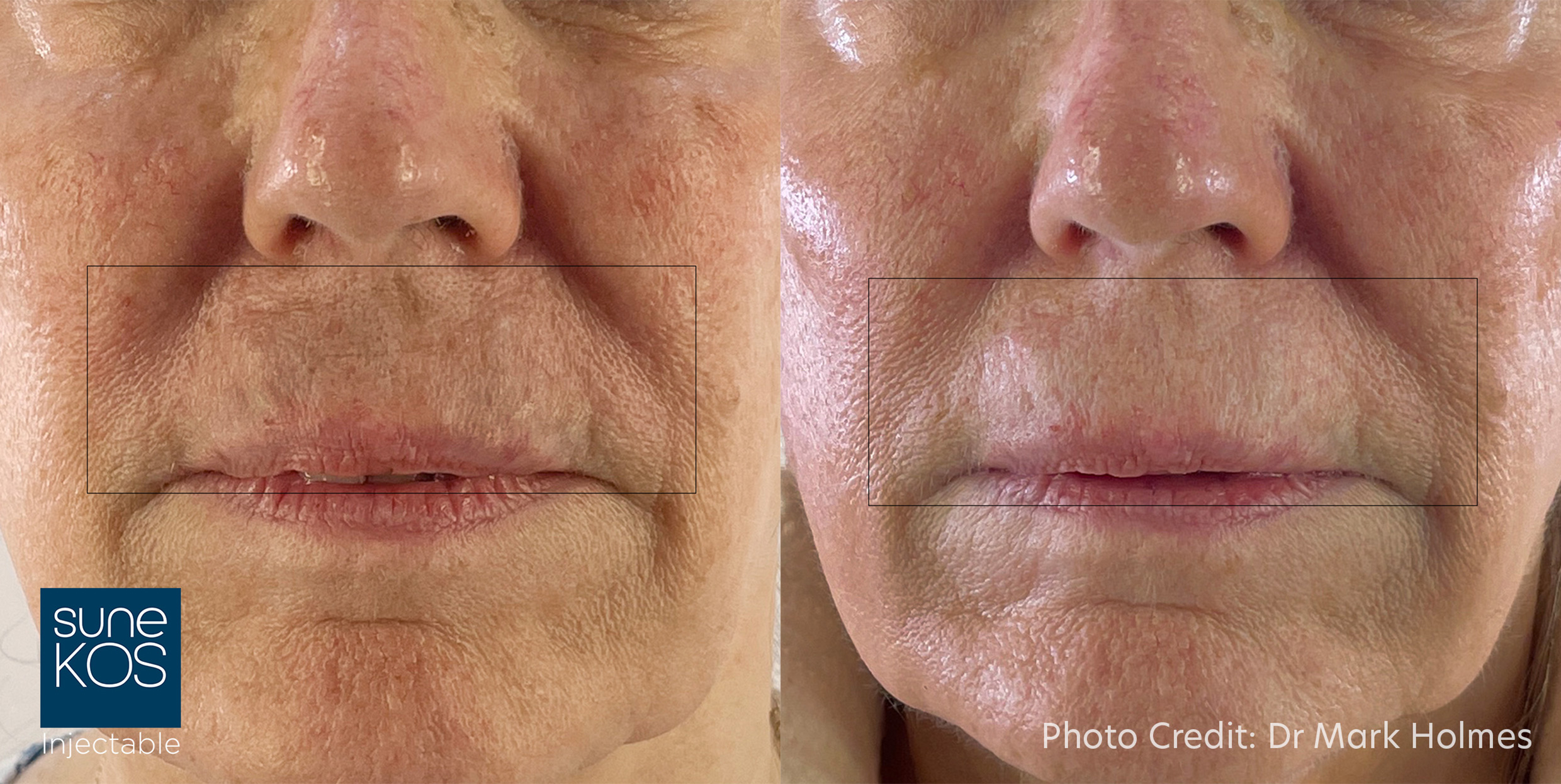 Sunekos - Brands - Professional Aesthetics - medfx